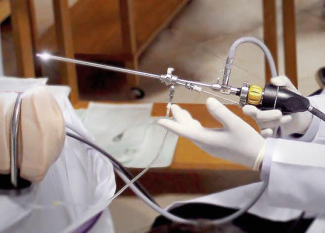 Tecnologia e excelência em Videohisteroscopia | IDOR – Instituto D'Or ...